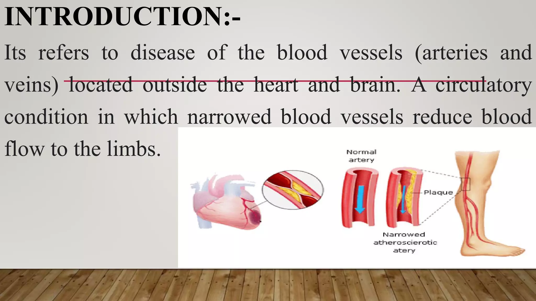 Peripheral vascular disorder.pdf