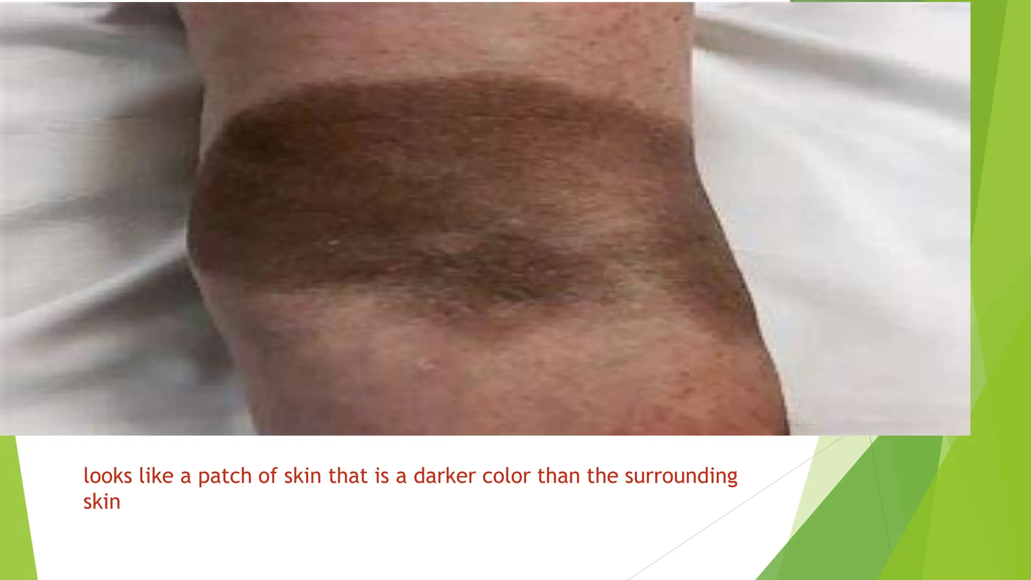 Peripheral vascular examination (2).pptx