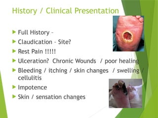 Peripheral Vascular Examination LECTURE 12 JULY 2023.pptx