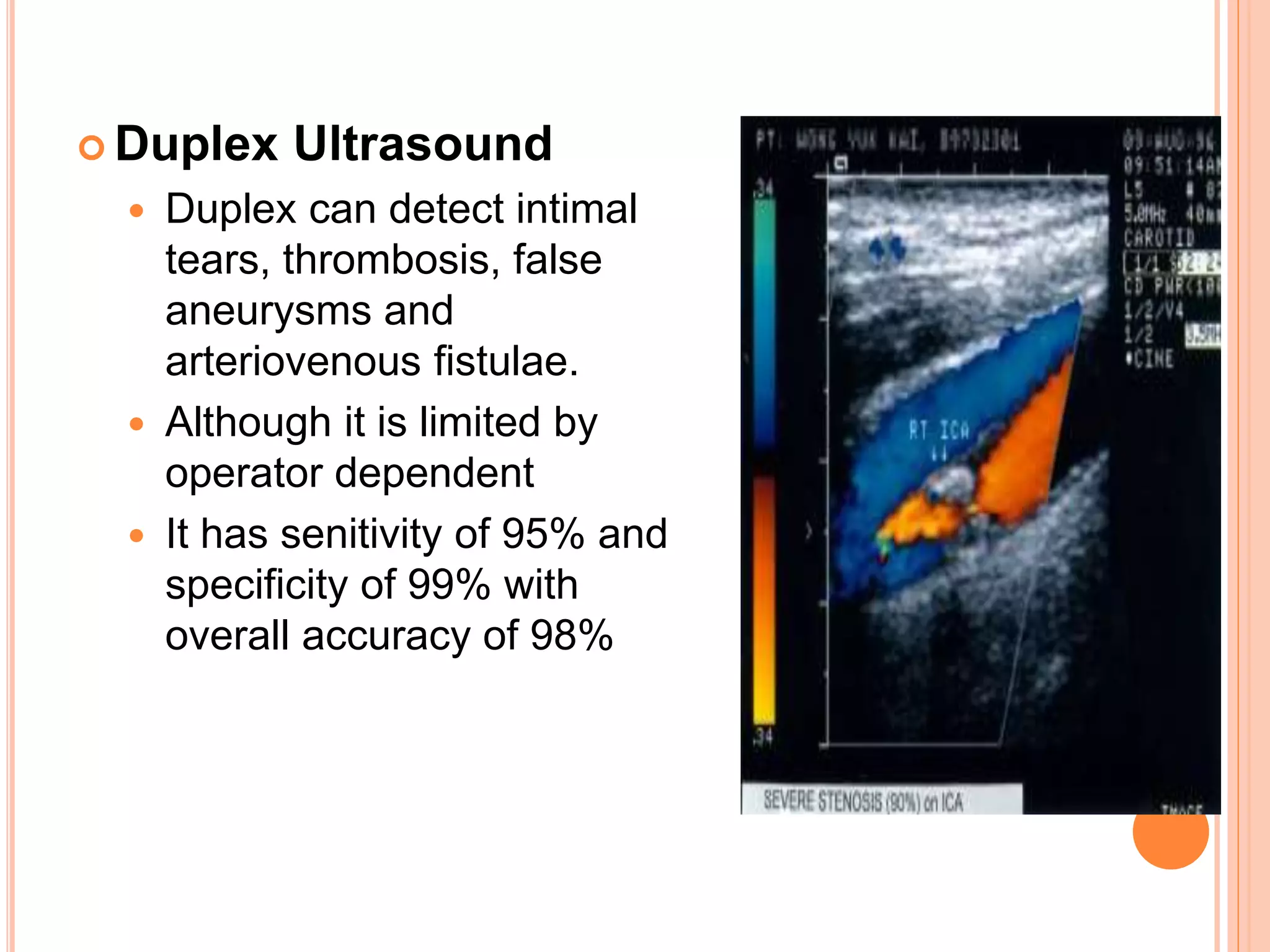 Peripheral Vascular Injuries | PPTX