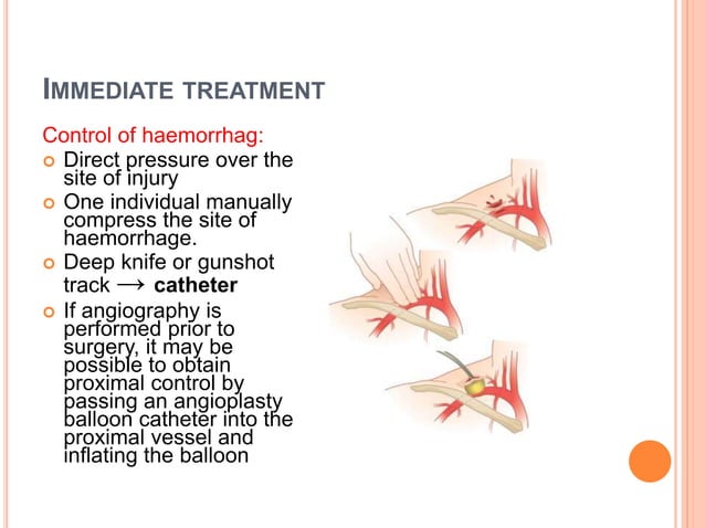 Peripheral Vascular Injuries | PPTX