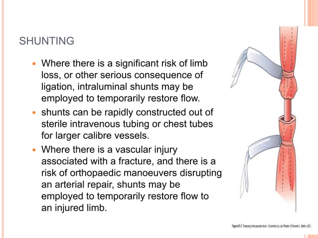 Peripheral Vascular Injuries | PPTX