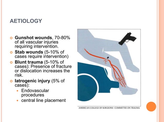 Peripheral Vascular Injuries | PPTX