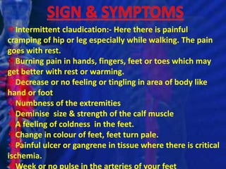 Peripheral vasculer disease | PPT