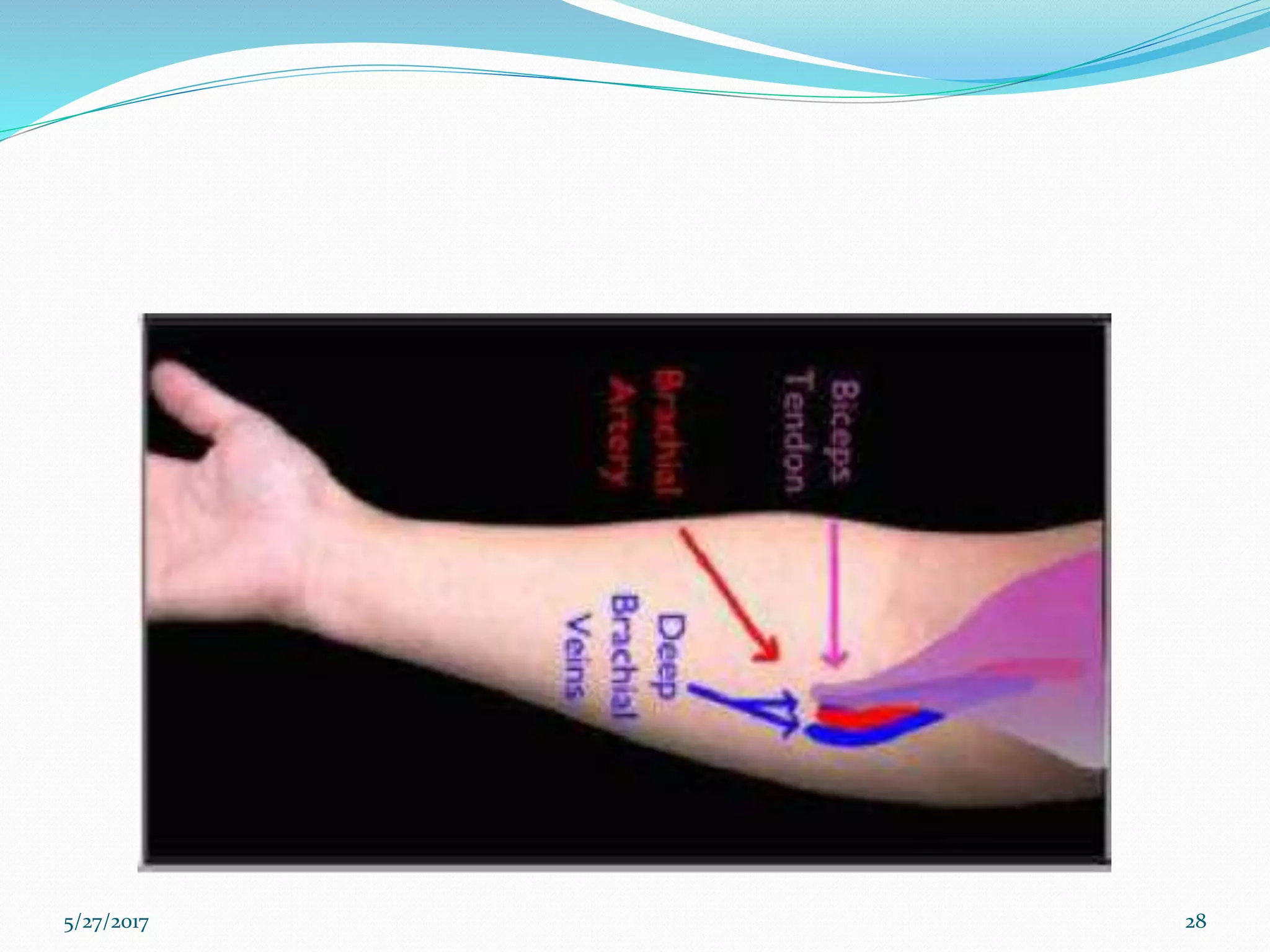 Peripheral venous cannulation | PPTX