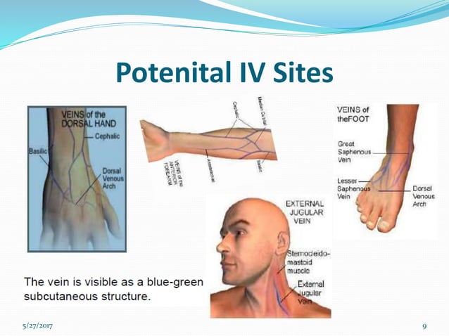 Peripheral venous cannulation