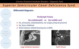 Peripheral vestibular disorders - Diagnostic tools | PDF