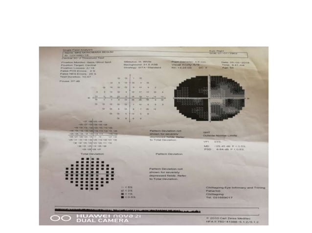 Peripheral visual field | PPTX