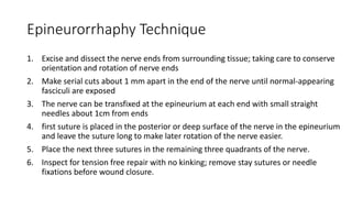 Peripherial nerve repair | PPTX