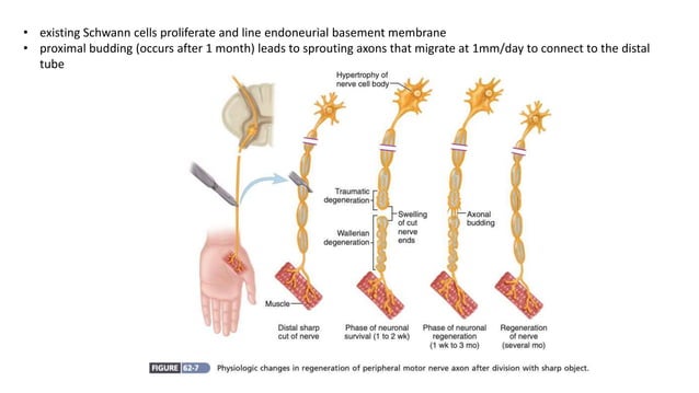 Peripherial nerve repair | PPTX