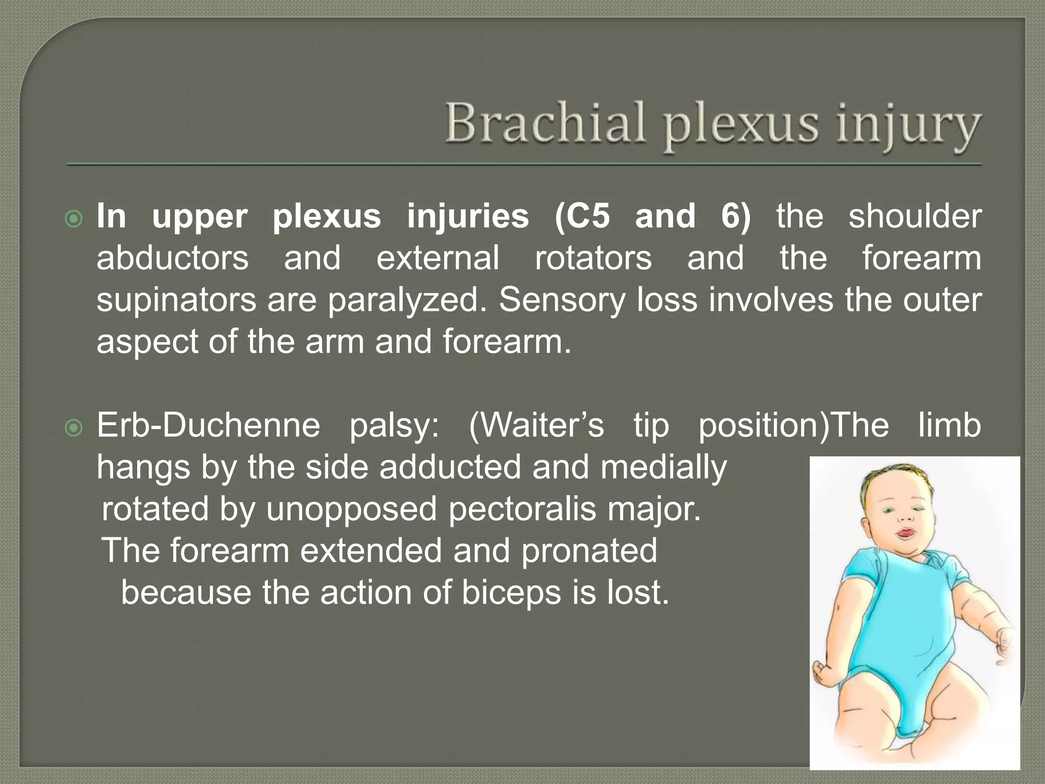 Periphral nerve injury | PPTX