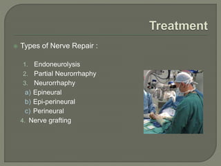 Periphral nerve injury | PPTX