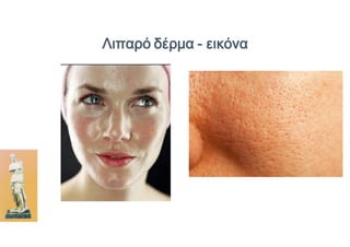 Λιπαρό δέρμα - περιποίηση στο ινστιτούτο αισθητικής και περιποίηση στο ...