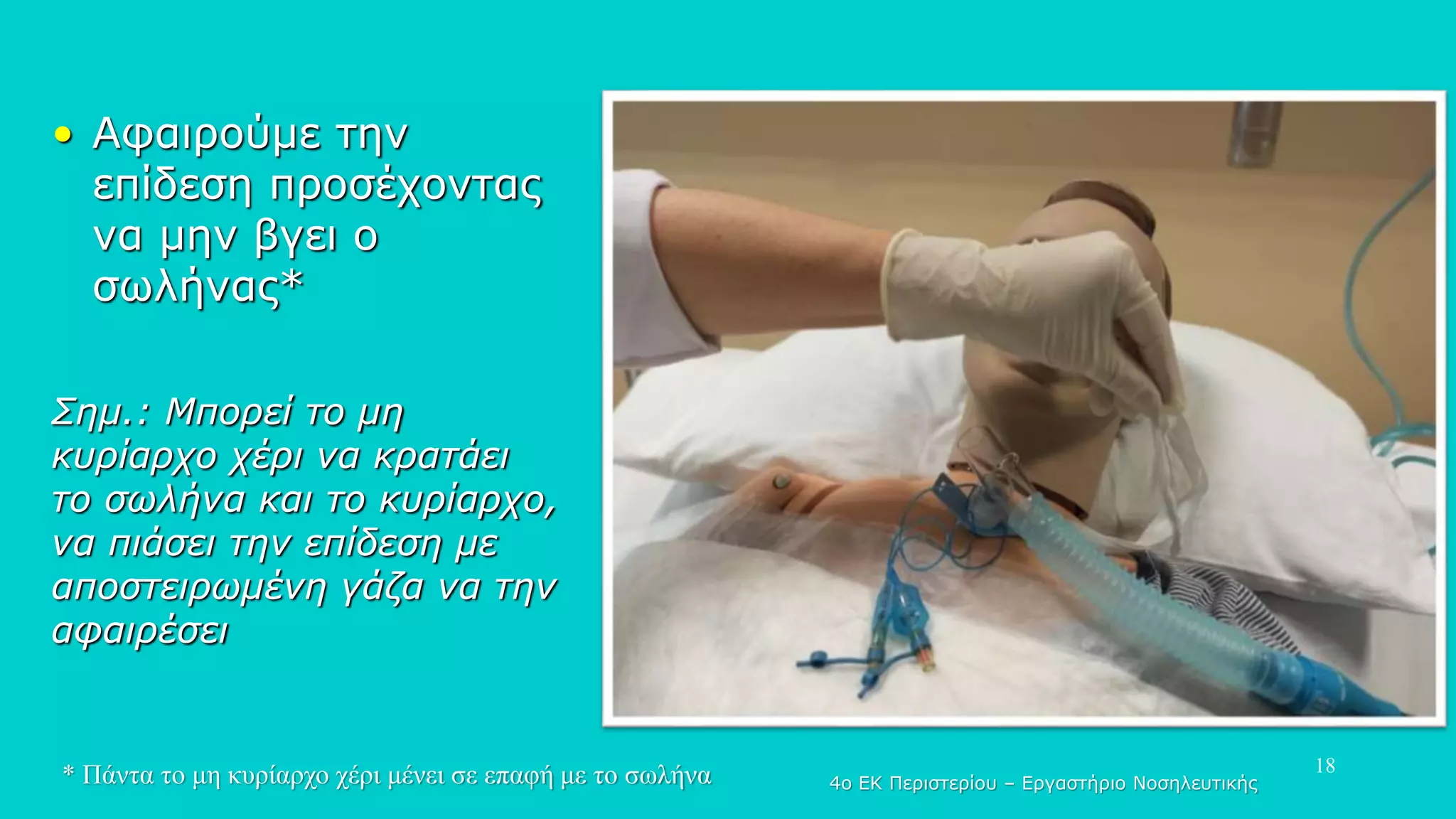 Φροντίδα τραχειοστομίας: Αλλαγή επιθέματος | PPTX