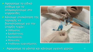 Φροντίδα τραχειοστομίας: Αλλαγή επιθέματος | PPTX