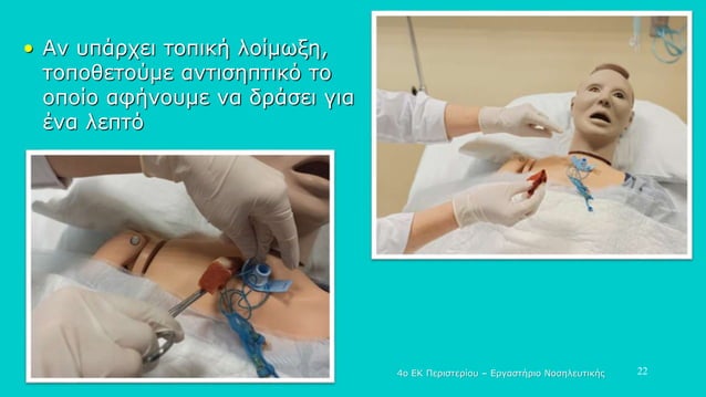 Φροντίδα τραχειοστομίας: Αλλαγή επιθέματος | PPTX
