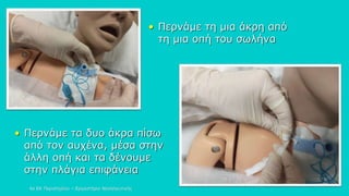 Φροντίδα τραχειοστομίας: Αλλαγή επιθέματος | PPTX