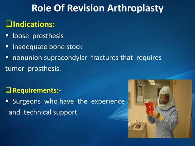 Periprosthetic fractures around the knee | PPTX | Death, Injury, or ...