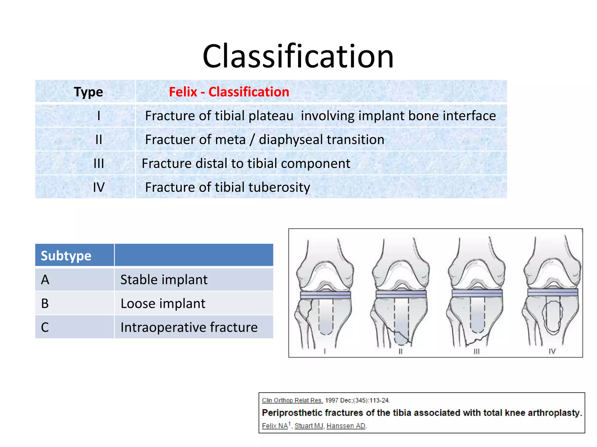Periprosthetic fracture | PPTX