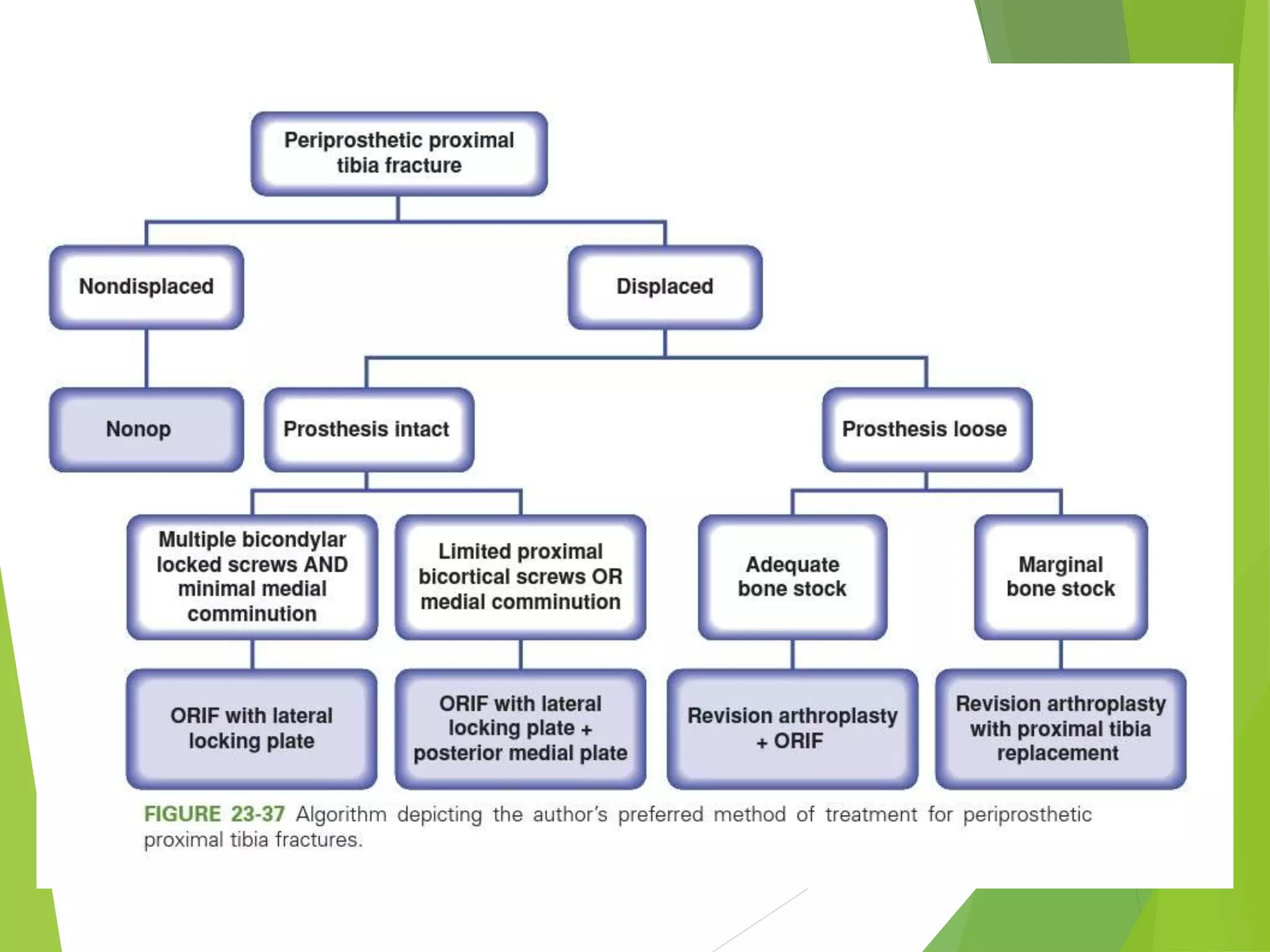 Peri prosthetic fracture | PPT