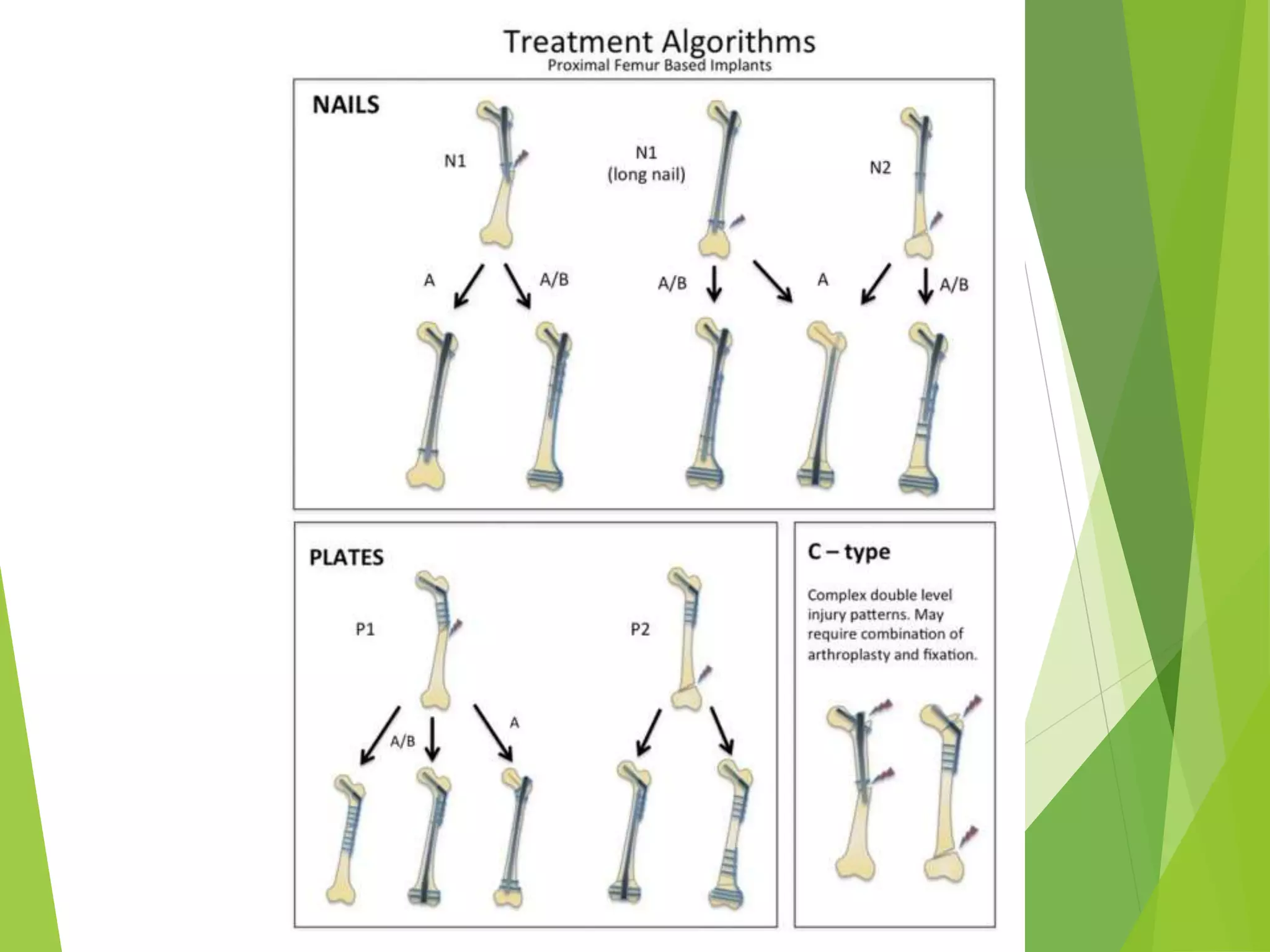 Peri prosthetic fracture | PPT