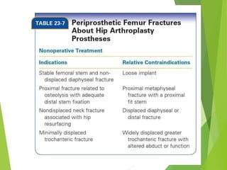 Peri prosthetic fracture | PPT