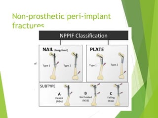 Peri prosthetic fracture | PPTX | Death, Injury, or Military Conflict ...