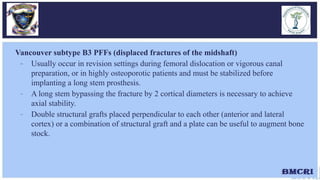 periprosthetic fracture around hio prosthesis | PDF