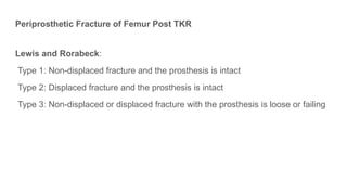 Peri prosthetic fractures.pptx.......... | PPT