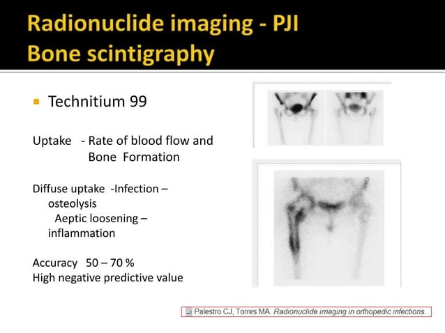 Periprosthetic joint infection | PPTX