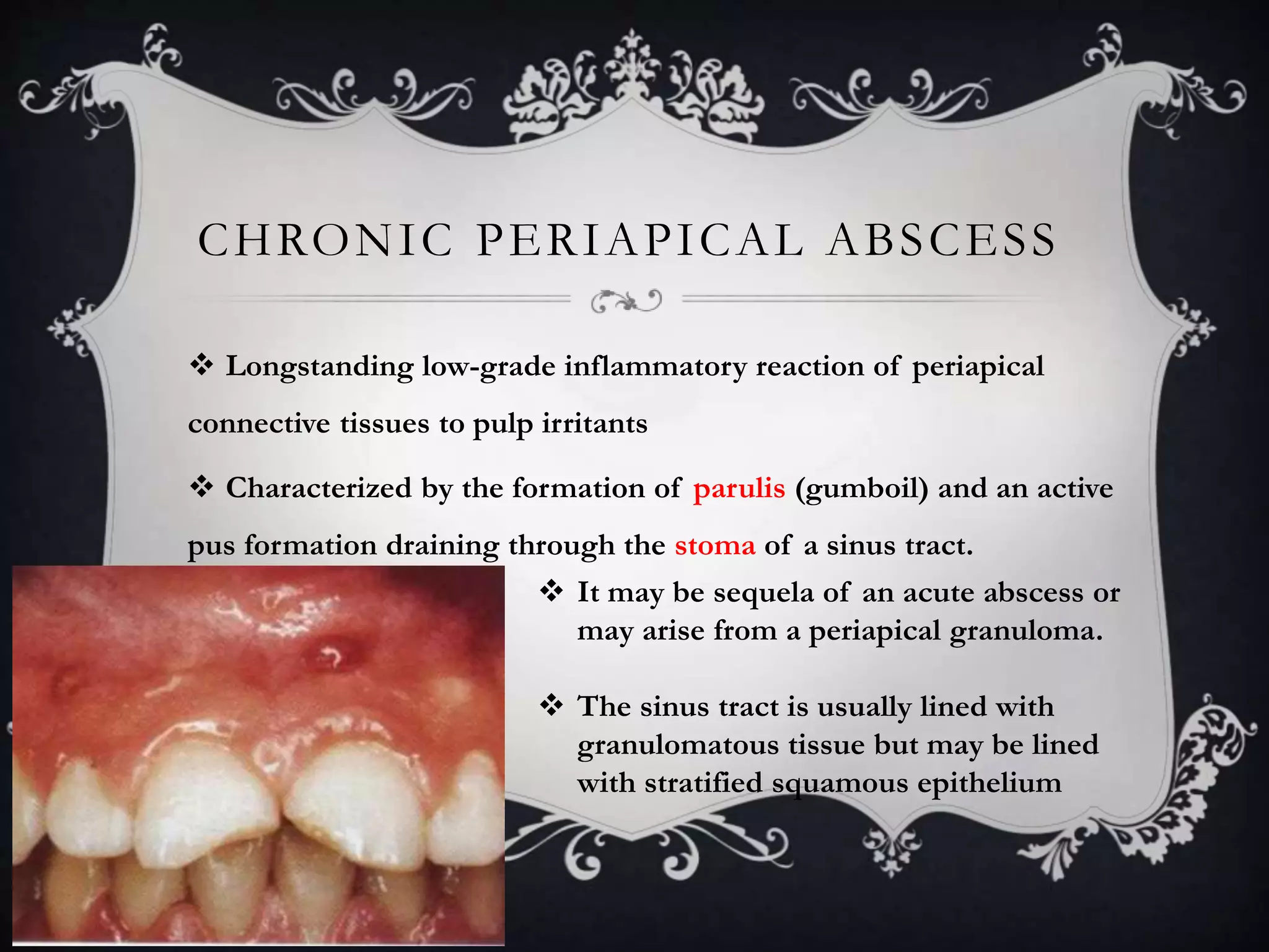 Periradicular Diseases | PPTX