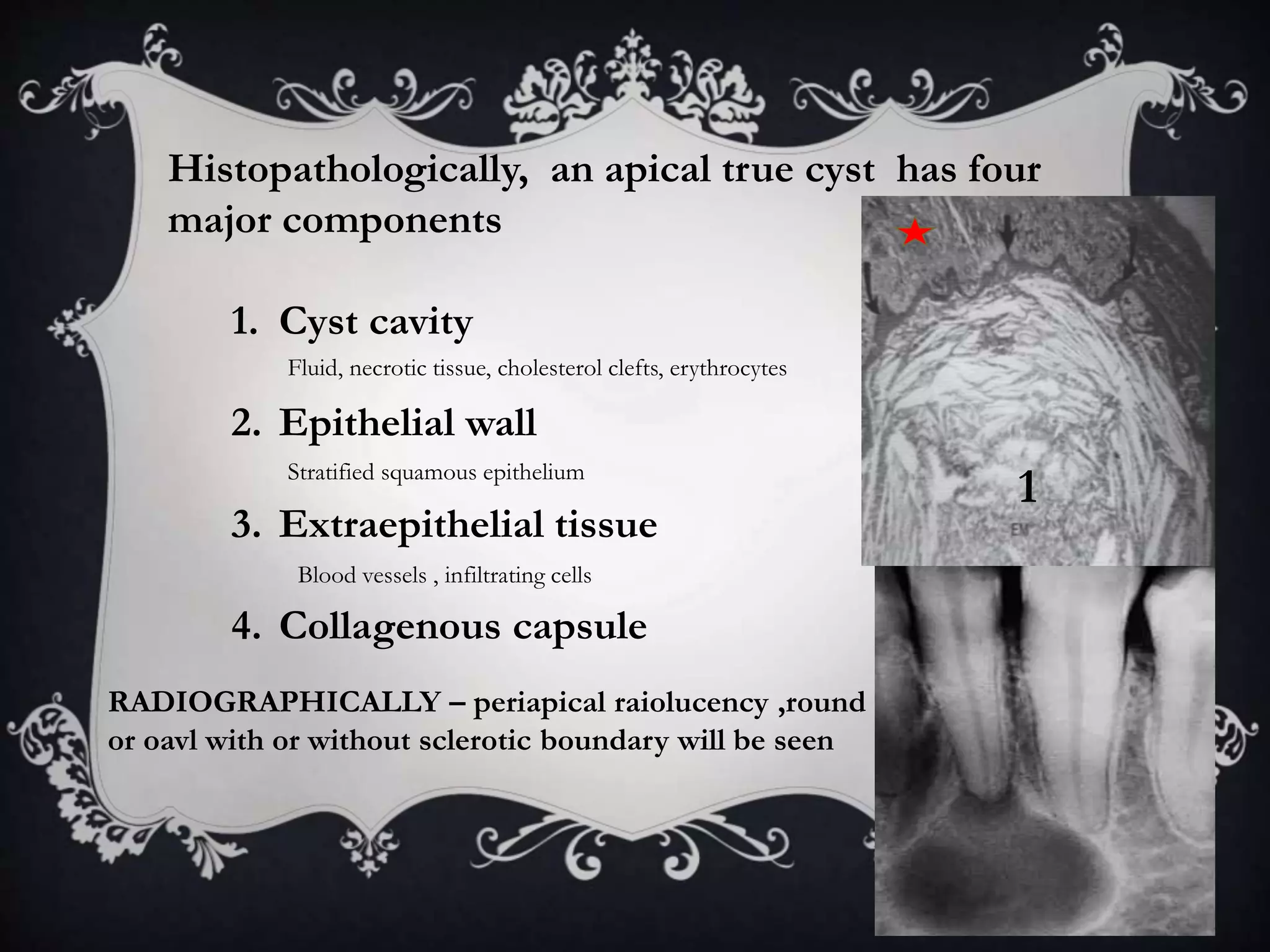 Periradicular Diseases | PPTX