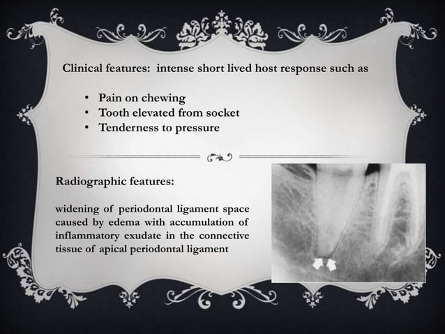 Periradicular Diseases | PPTX | Dental Health | Diseases and Conditions