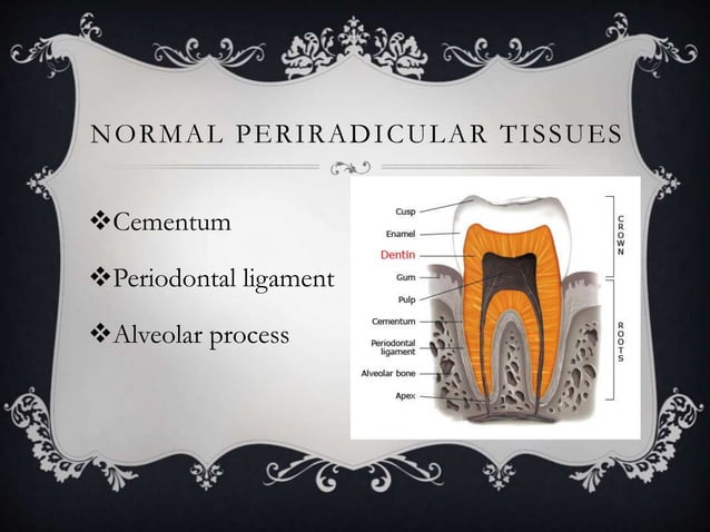 Periradicular Diseases | PPTX | Dental Health | Diseases and Conditions