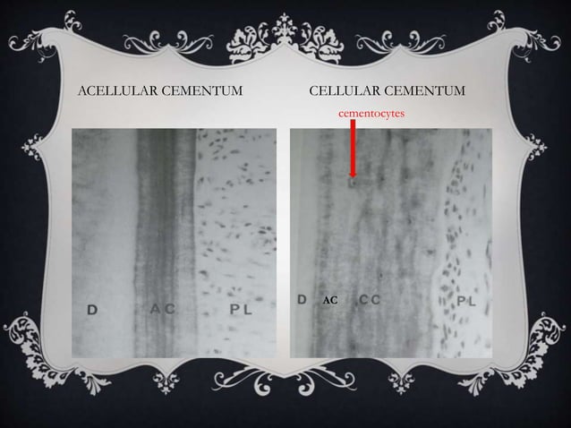 Periradicular Diseases | PPTX | Dental Health | Diseases and Conditions