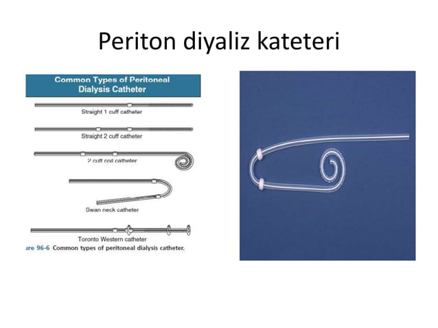 Periton diyalizi | PPTX