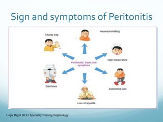 Peritoneal-Dialysis-exam-review.pptx