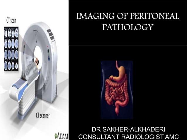 Imaging Of Peritoneal Pathology | PPTX