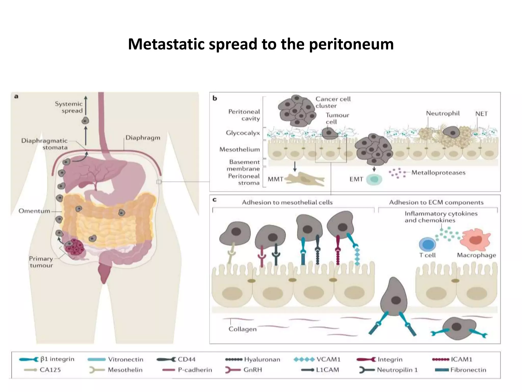Peritoneal Carcinomatosis.pptx