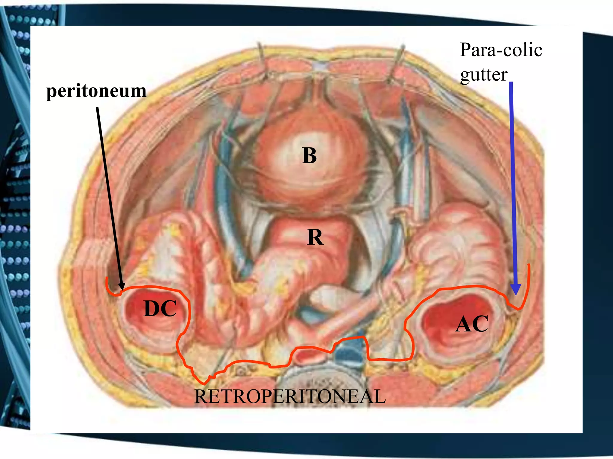 Peritoneal cavity and relations | PPT | Death, Injury, or Military ...