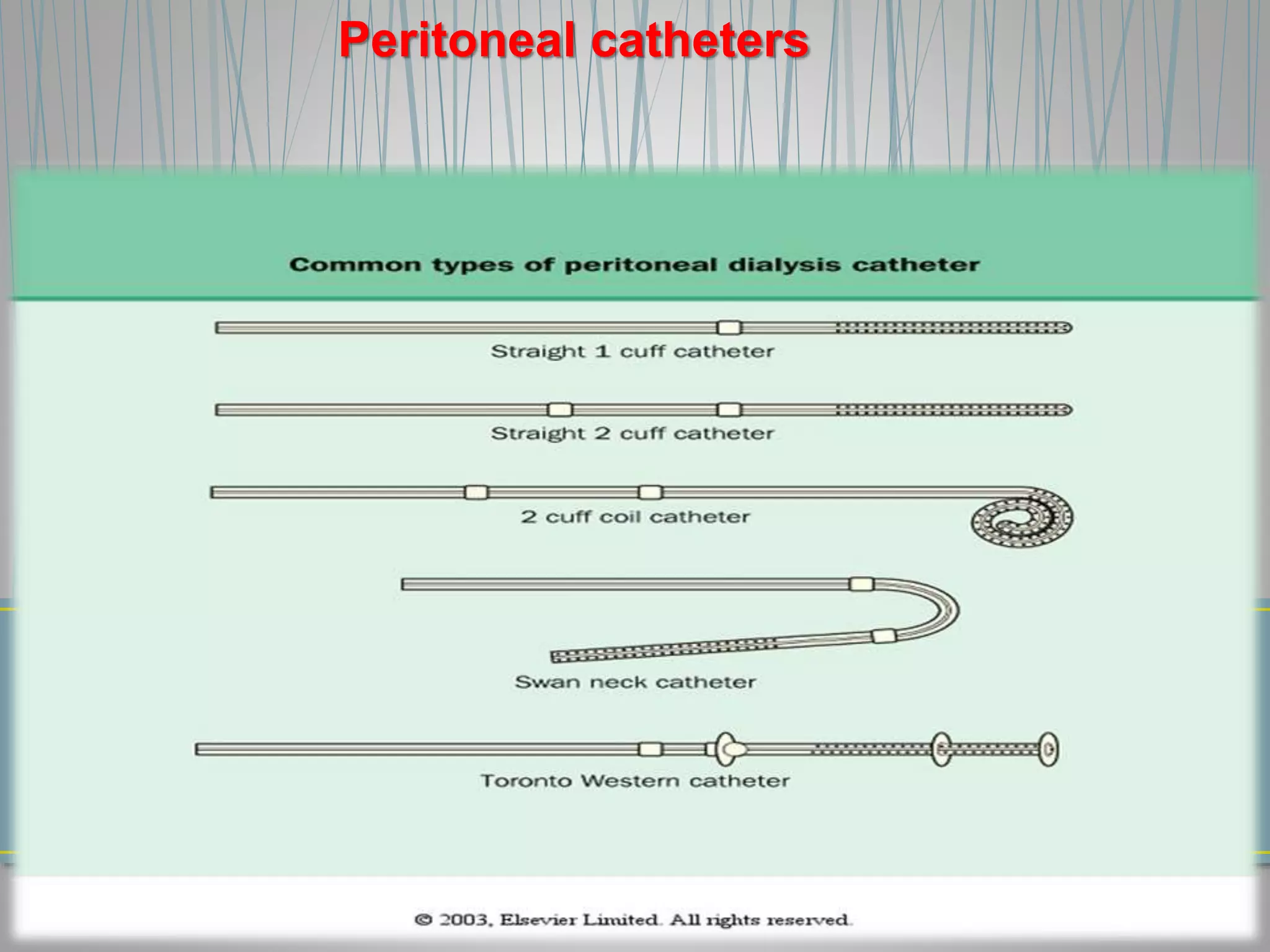 Peritoneal dialysis 2 | PPTX