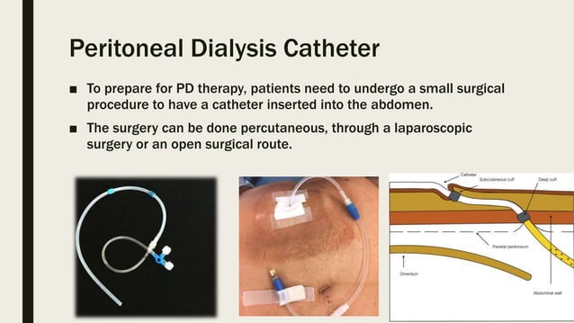 peritoneal dialysis | PPTX