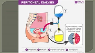 peritoneal dialysis.pptx