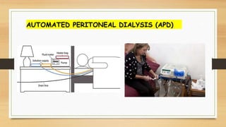 Nursing management of patient with peritoneal dialysis | PPTX