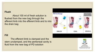 Peritoneal Dialysis, Principles and types | PPTX