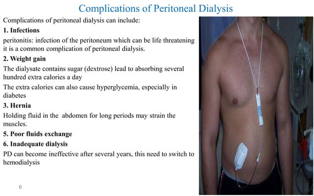 Medical Surgical Nursing PERITONEAL DIALYSIS 2024.ppsx