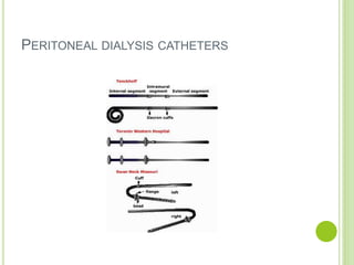 Peritoneal Dialysis Catheter Types
