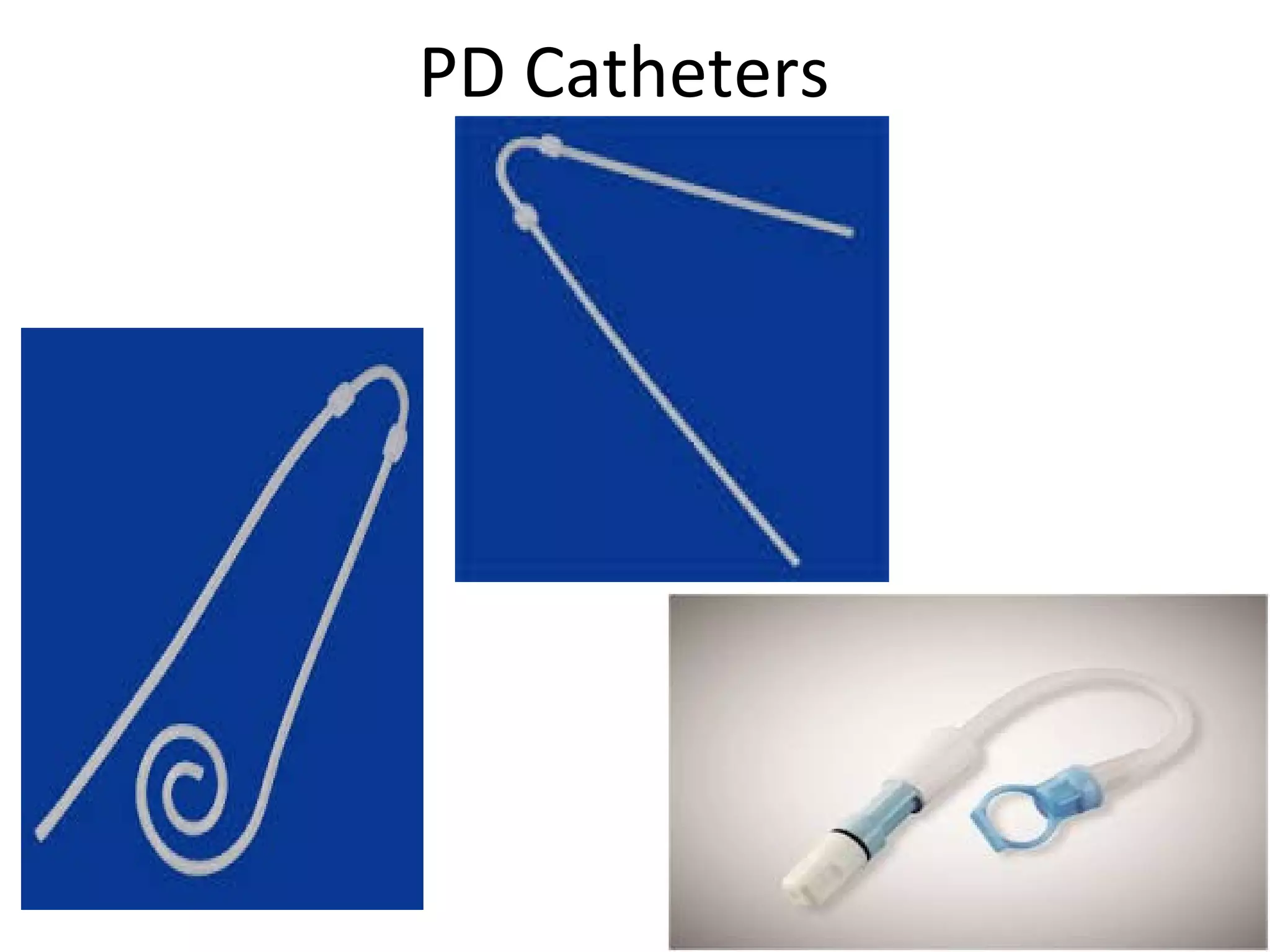 Peritoneal dialysis in children | PPT
