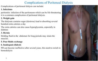 Peritoneal dialysis msn | PPT