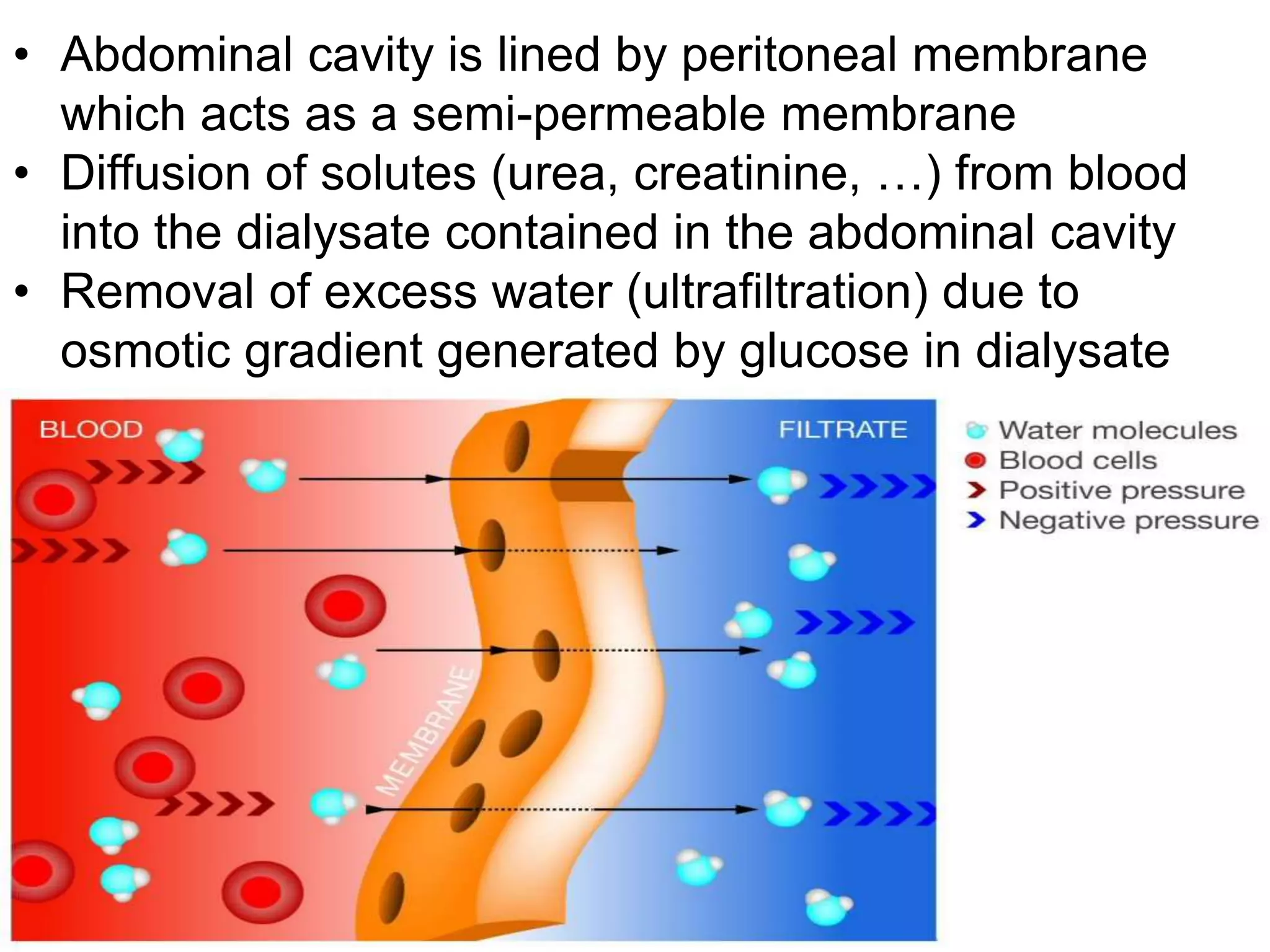 Peritoneal dialysis by Dr. Basil Tumaini | PPTX